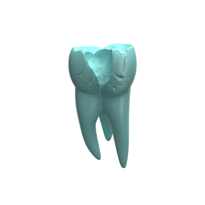 XLH signs and Symptoms in Adults | For HCPs